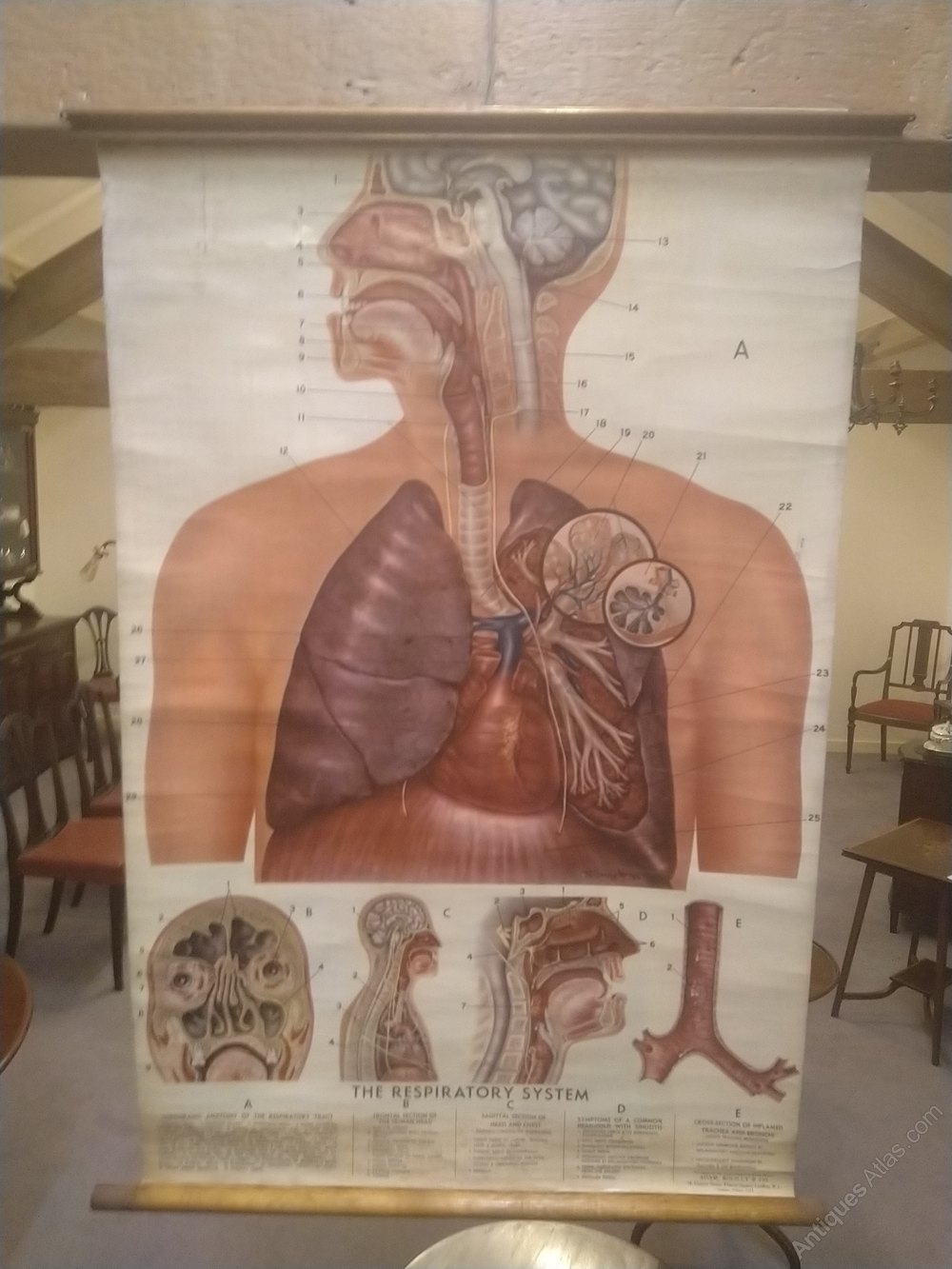Antiques Atlas - Anotomical Chart, Respiratory