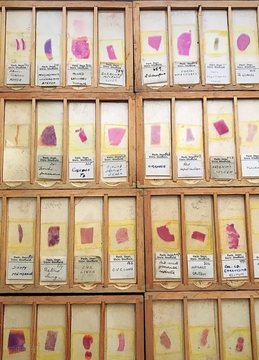 Antiques Atlas - Pathology Slides From Sheffield University